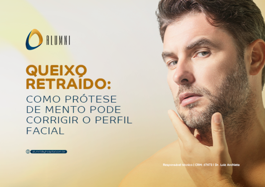 Queixo retraído? Como prótese de mento pode corrigir o perfil facial ...